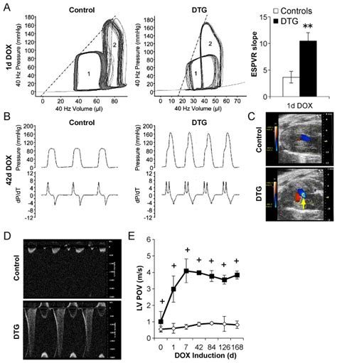 A Representative Pressure Volume PV Loops At Baseline And Download Scientific Diagram