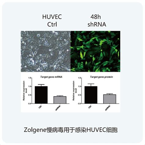 过表达慢病毒包装400 1000 bp滴度108TU 病毒包装 广州科梵生物技术有限公司