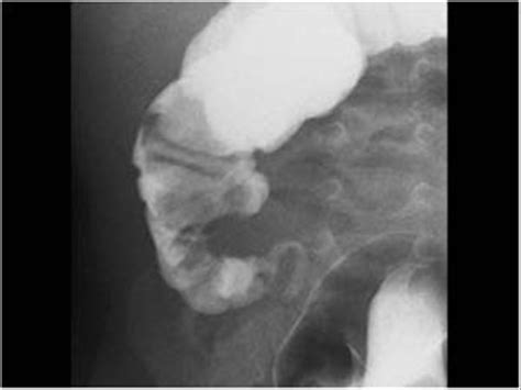 Pediatrics 91 Pediatric Abdomen And Retroperitoneum Case 912