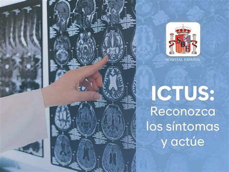 Ictus Reconozca Los Síntomas Y Actúe Hospital Español