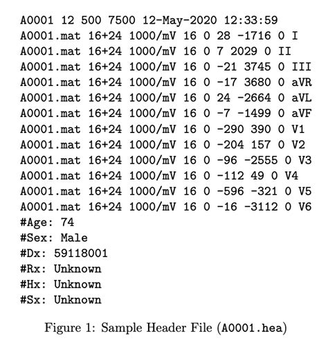 remove trailing white space between verbatim and caption in a figure