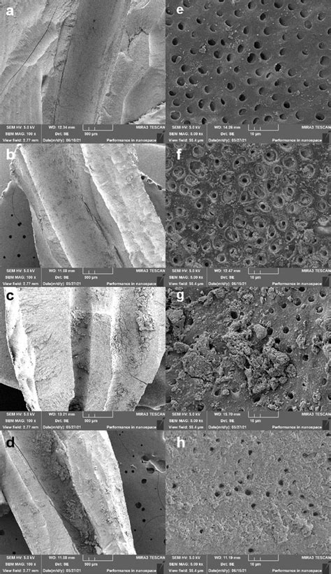 Representative Sem Photos Of Debris × 100 And Smear Layer × 5000 A