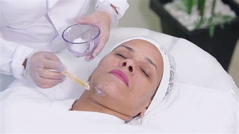 Peeling Químico Curso Online Youtube