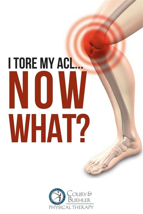Acl Tear Artofit