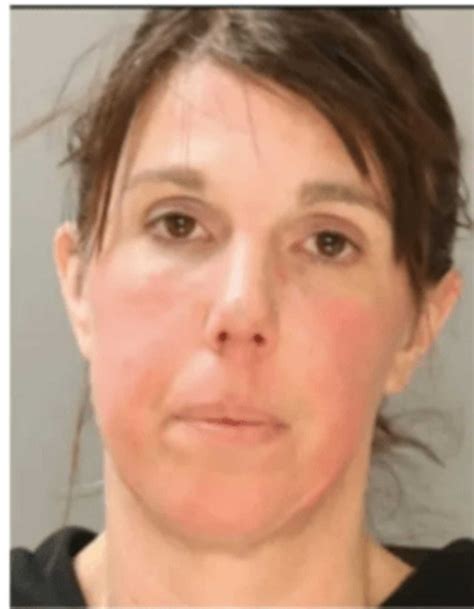 Serial Dog Thief Busted Again Hunterdon County Prosecutor Warren