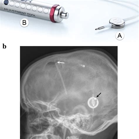 A Cochlear™ Nucleus® Ci632 Implant Cochlear Americas Lone Tree Co Download Scientific
