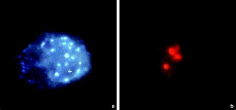 B Stricta A DAPI Stained Interphase Nucleus With 17 Chromocentres