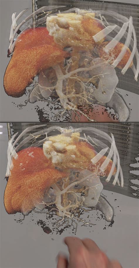Gastrointestinal Learning Modules Ct Scanning