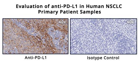 Leveraging Ihc As A Powerful Clinical Tool For Io Therapies