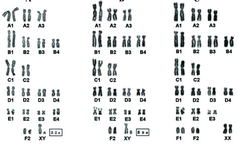 Conventional Staining Of Chromosomes А The Far Eastern Leopard Cat Download Scientific