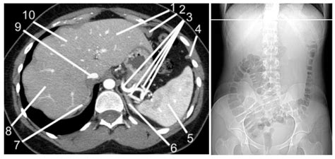 Axial Contrast Enhanced Abdomen W St Windows 6 Diagram Quizlet