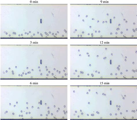 Eosinophil Chemotaxis Toward Concentration Gradient Of Pgd 2 Images