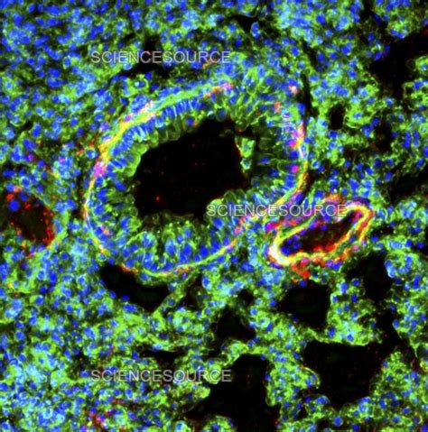 Lung Bronchiole Fluorescence Microgra Stock Image Science Source Images