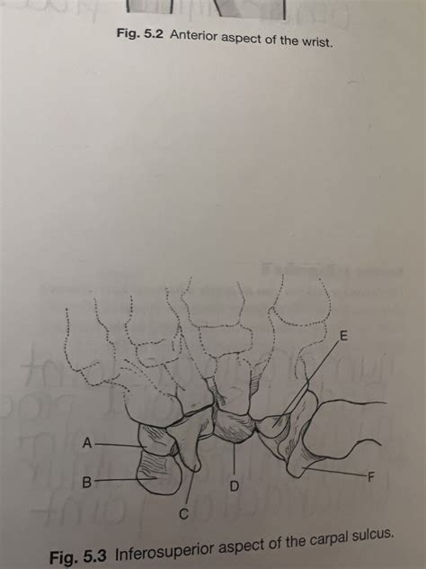 Tangential Projection Gaynor Hart Method Diagram Quizlet