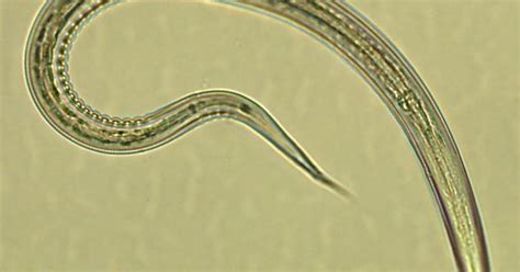 Eddie A On Linkedin Hookworms Successfully Prevent Type 2 Diabetes In