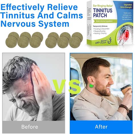 Yakitoko Alivio De Tinnitus Para Oídos Zumbidos Parches De Tratamiento