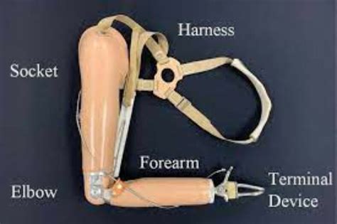 An Introduction To Different Types Of Prosthetics For Amputees