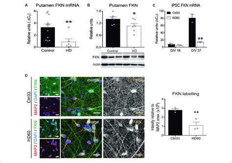 Fractalkine Expression Is Decreased In Human Hd Striatum And