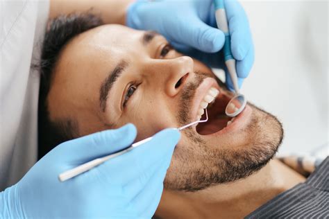 Sarro negro causas y cómo eliminarlo Dental Company