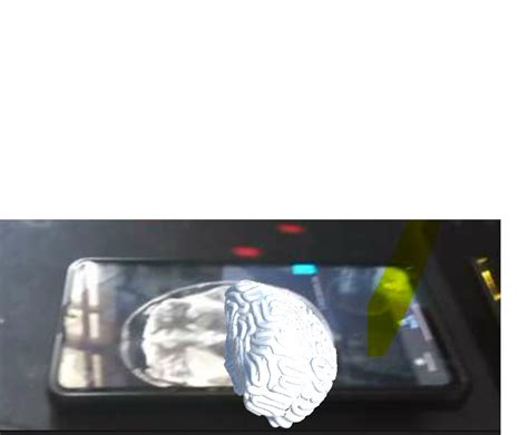 GitHub Srinithi MRI AR RADIOLOGY USING AUGMENTED REALITY