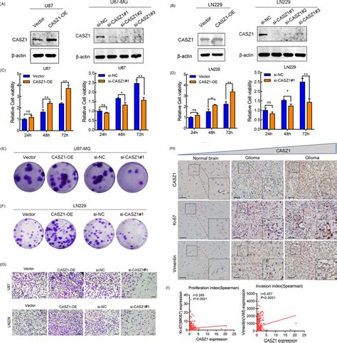 Casz1 Increases Proliferation And Invasion Abilities Of Glioma Cells Download Scientific
