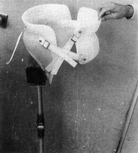 Figure 3 Posterior View Of Hemipelvectomy Set Oandp Digital Resource