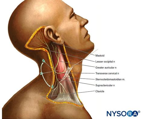 Cervical Plexus Block Landmarks And Nerve Stimulator Technique Nysora