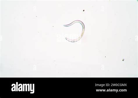 Nematode Worm On A White Background In Center Of Frame Under A