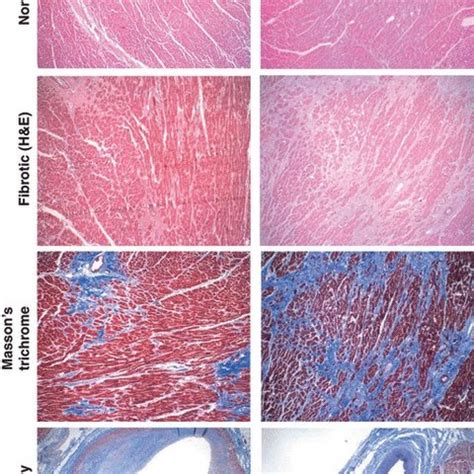 Examples Of Histological Comparisons Of Human And Chimpanzee Hearts And Download Scientific
