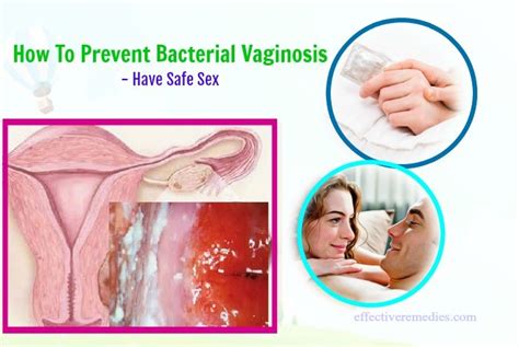 6 Best Tips On How To Prevent Bacterial Vaginosis Effectively