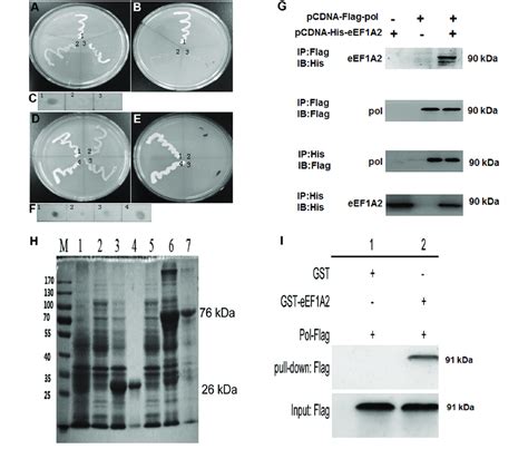 A Yeast Two Hybrid Analysis Of In Vitro Interaction Between Hbv Pol And