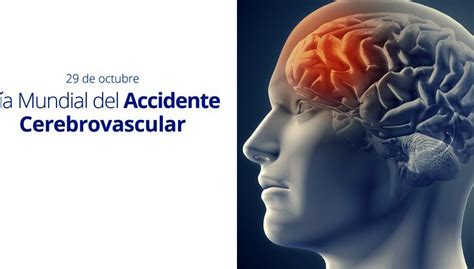 ¿cómo Saber Si Estoy En Riesgo De Sufrir Un Acv Los 17 Factores Que