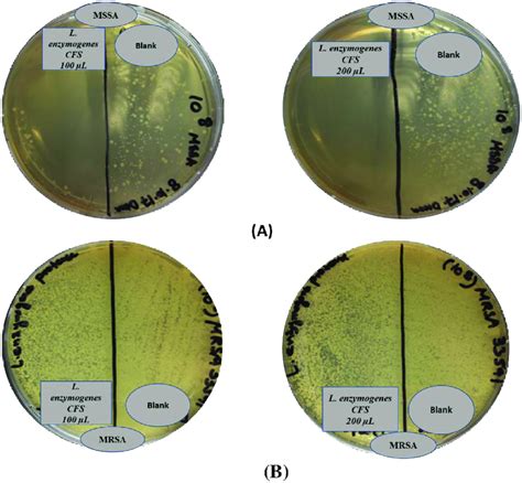 L Enzymogenes Cfs Growth Inhibitory Activity Against A Mssa B Download Scientific