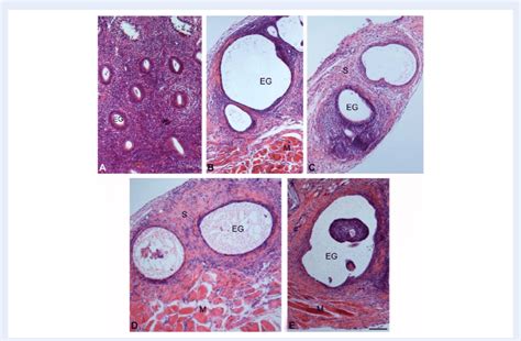 He Stained Sections Of Native Endometrium Of The Proliferative Phase Download Scientific