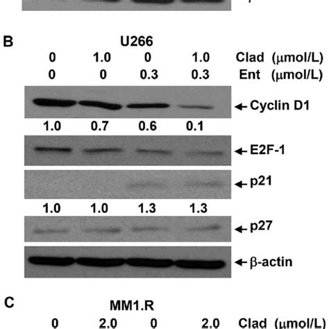 Combination Of Cladribine And Entinostat Causes A Profound Mitotic