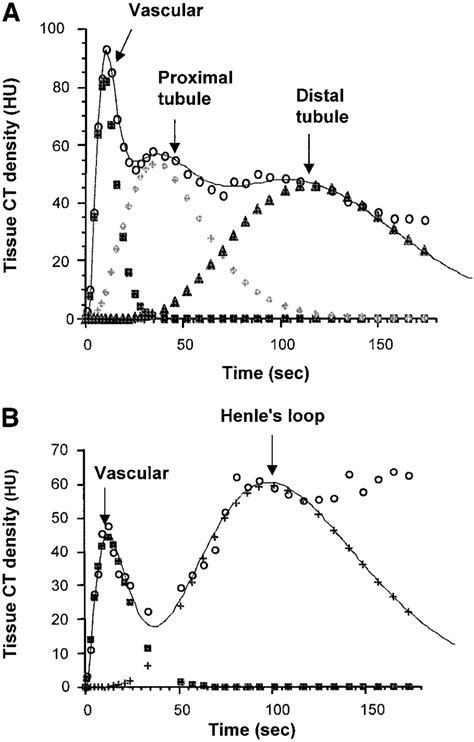 Time Density Curves Obtained With Electron Beam Computed Tomography