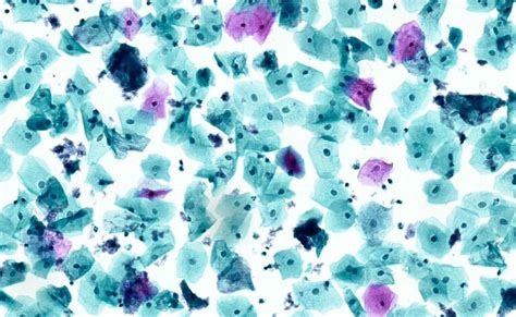 Deep Learning Method Essentials For Nuclei Segmentation