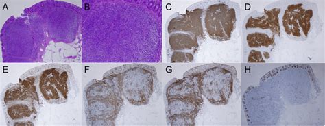 A B Histopathologic Examination Of The Caecal Polyp Revealed