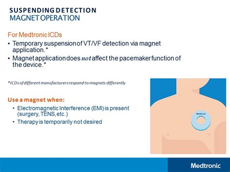 Cvt Mohd Farid Concept Of Icd Technology Sensing And Detection Medtronic Academy
