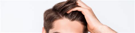 Pasadena CA Forehead Reduction Surgery Glendale Hairline Lowering