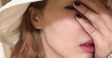 현아 대학축제 무대서 꽈당응급실行 걱정끼쳐 미안