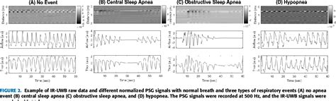 Figure 2 From Hybrid Cnn Lstm Network For Real Time Apnea Hypopnea Event Detection Based On Ir