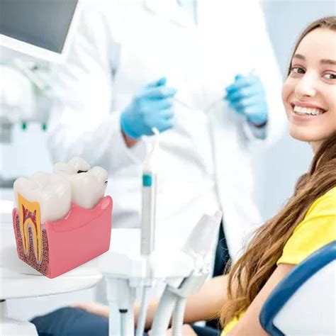 Tooth Caries Model 6x Enlarged Caries Demonstration For Dental