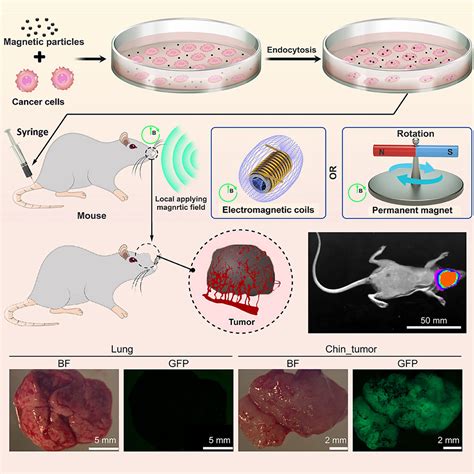 Magnetically Powered Cancer Cell Microrobots For Surgery Free