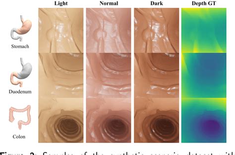 Figure 2 From A Geometry Aware Deep Network For Depth Estimation In