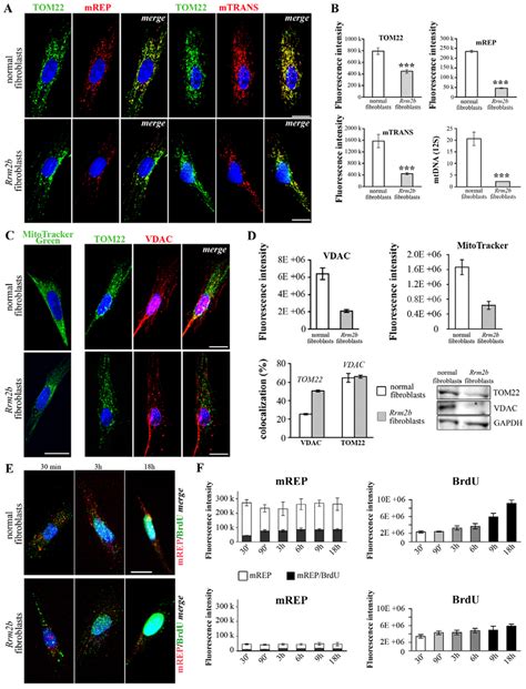 Mtrip Detects Mtdna Processing Alterations In Cells Of A Patient With Download Scientific