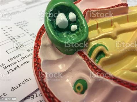 담석 십이지장 및 췌장을 가진 인간 담즙 방광의 해부학 모형 3차원 형태에 대한 스톡 사진 및 기타 이미지 3차원 형태 간