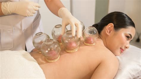Cupping Therapy Chinese History