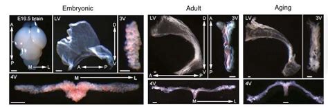 An Atlas Of The Brains Choroid Plexus Across The Lifespan