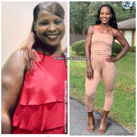 Pin On Before And After Weight Loss Stories